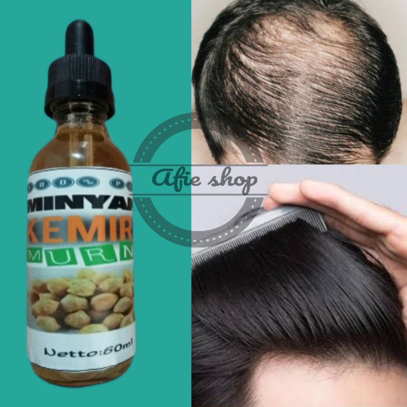 Jual MINYAK KEMIRI ASLI MURNI PENUMBUH RAMBUT DEWASA ANAK DAN BAYI ...