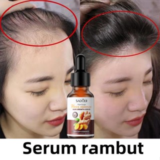 Jual Penumbuh Rambut Serum Rambut Rontok Perawatan Rambut Hair Growth ...