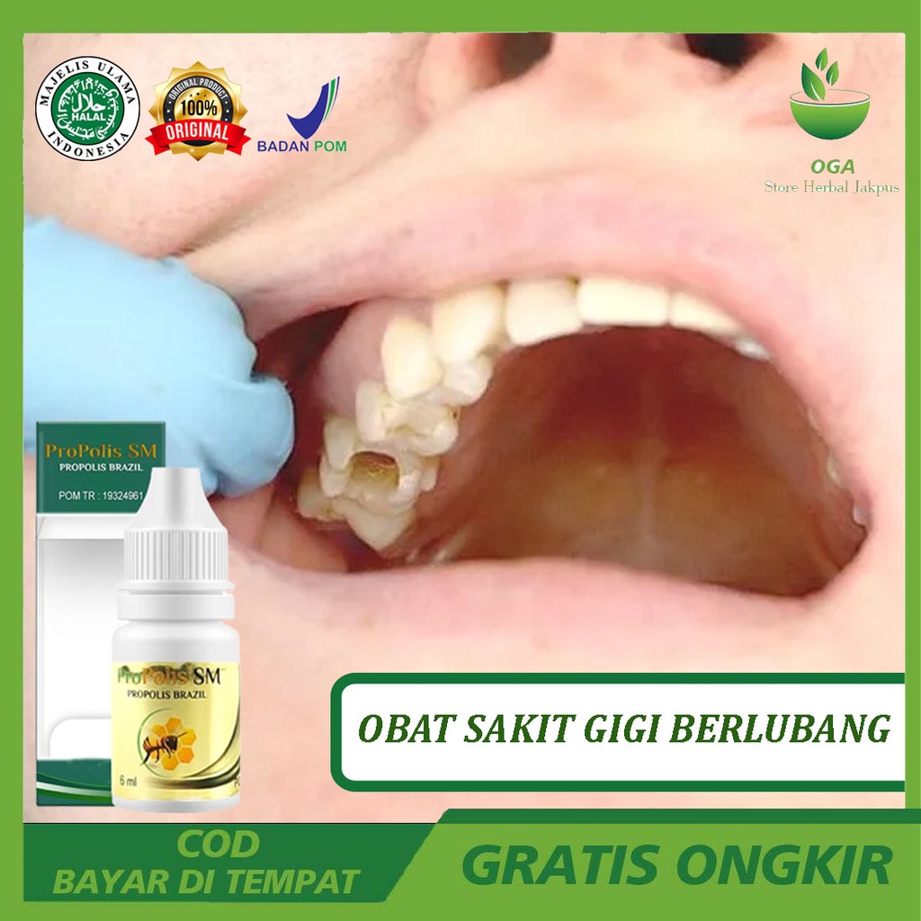 Jual Obat Sakit Gigi Berlubang Bau Mulut Tak Sedap Sariawan Gusi ...
