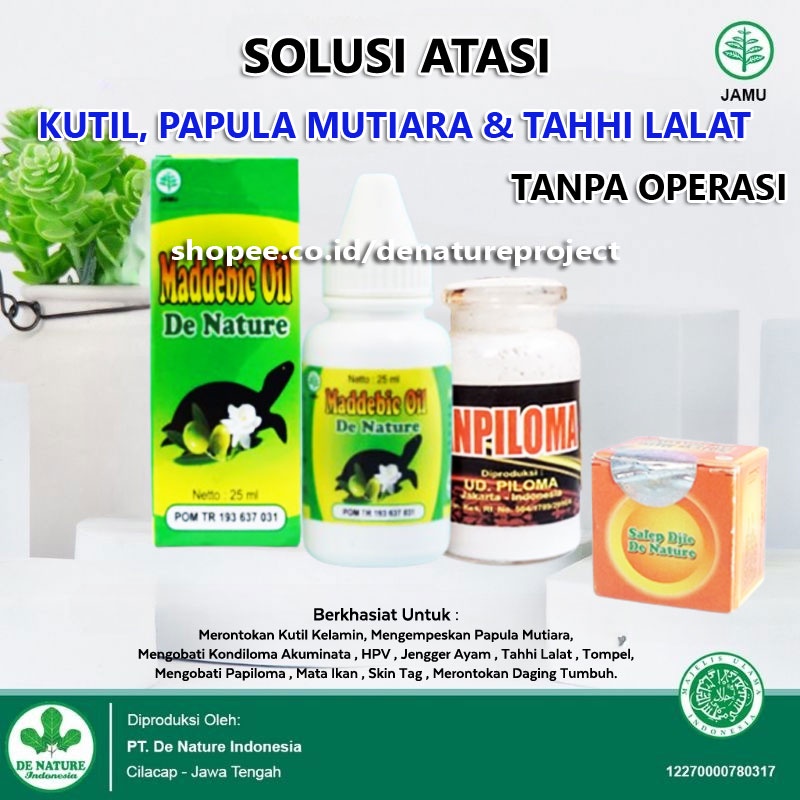 Jual MDBC OIL! Salep Obat Kutil Di Leher | Perontok Kutil Muka Jari ...