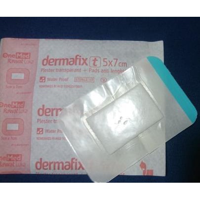 Jual Plester Infus Transparan OneMed Plaster Infus Perban Bening ...
