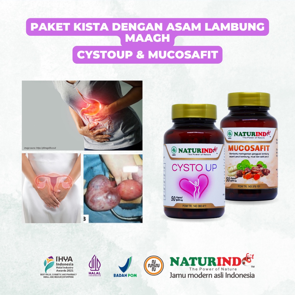 Jual OBAT KISTA OVARIUM BARTHOOLIN GANGLION MIOM MYOM YG PALING AMPUH ...