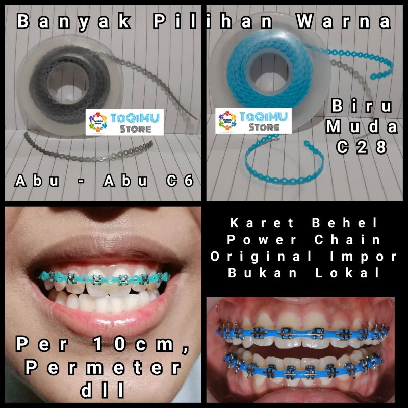 Jual karet power chain rantai gandeng per 10cm karet behel gigi premium ...