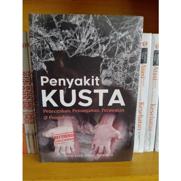 Jual Penyakit Kusta, Pencegahan, Penanganan, Perawatan Dan Pengobatan ...