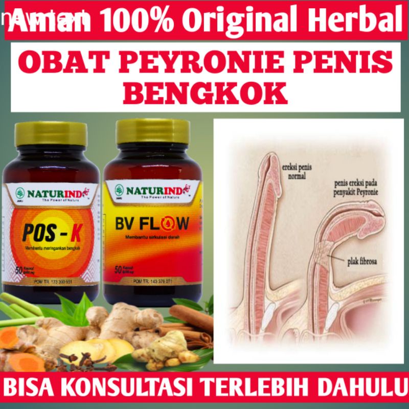 Jual Obat Penis Bengkok, Obat Pelurus Penis Bengkok ke Atas Penis Bengkok ke samping | Shopee ...