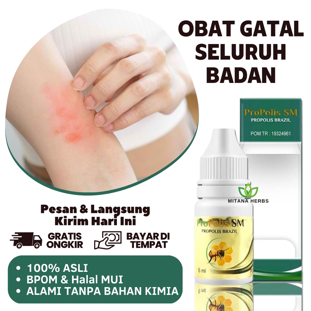 Jual Obat Gatal Di Seluruh Badan, Penghilang Gatal Di Badan, Gatal Di ...