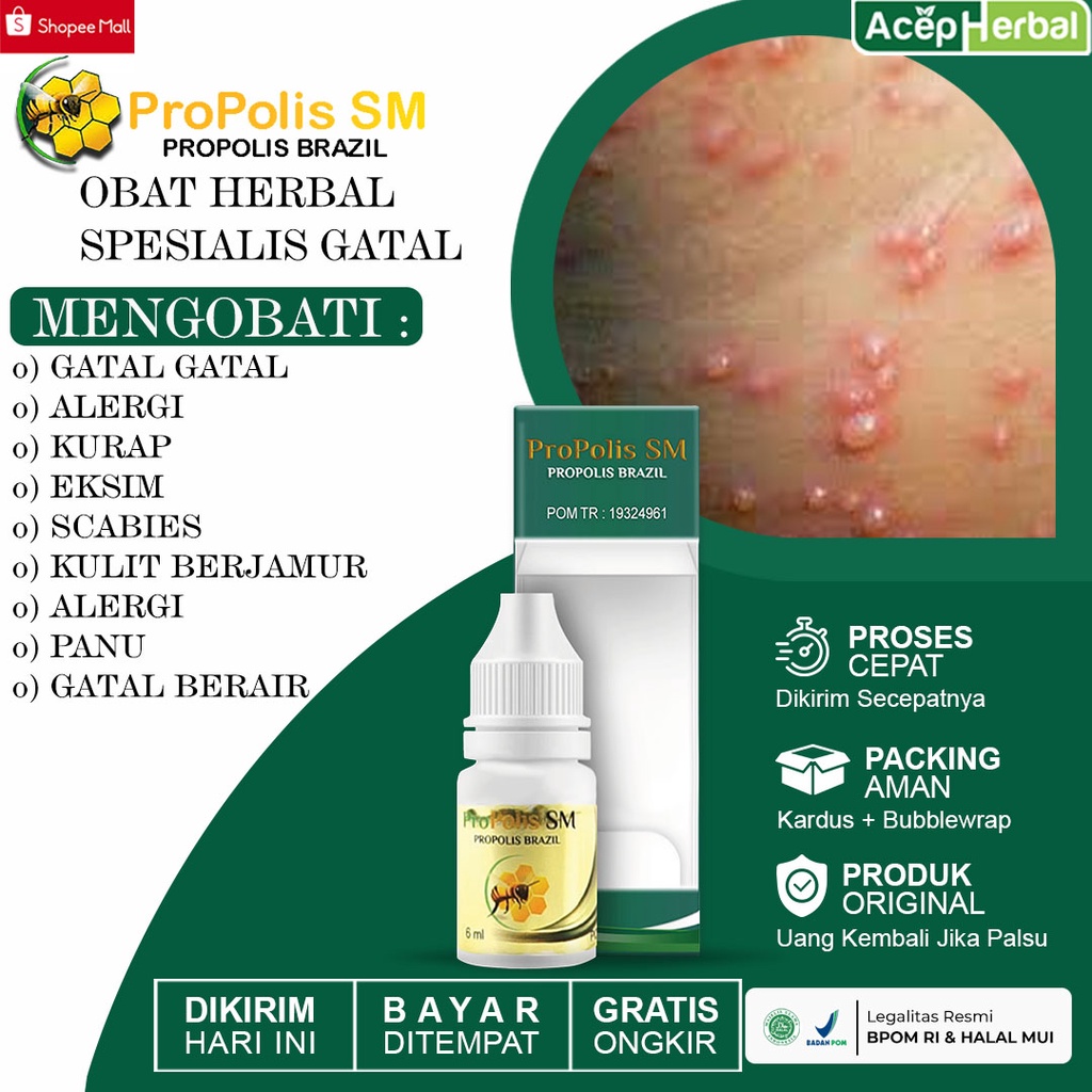 Jual Obat Gatal Gatal Di Badan Eksim Kurap Panu Jamur Psoriasis Scabies ...