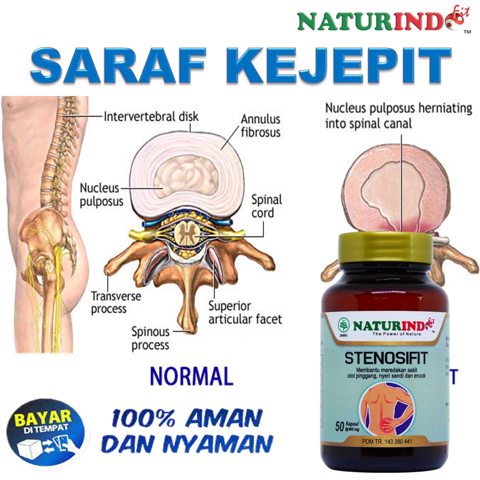 Jual Obat Sakit Pinggang Saraf Kejepit Dan Syaraf Terjepit Sakit Bokong Encok | Shopee Indonesia