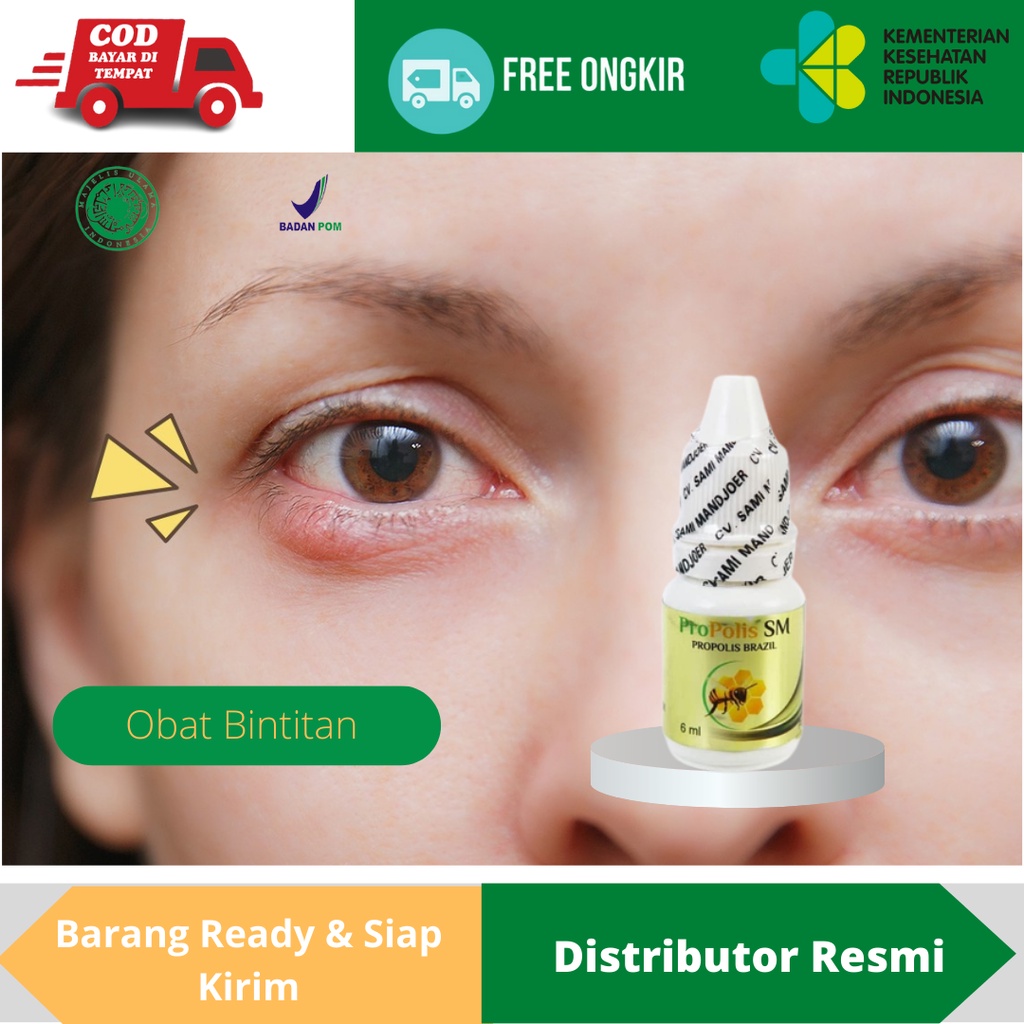 Jual Obat Herbal Mata Bintitan, obat Mata Bintitan Di Bawah Mata, obat ...