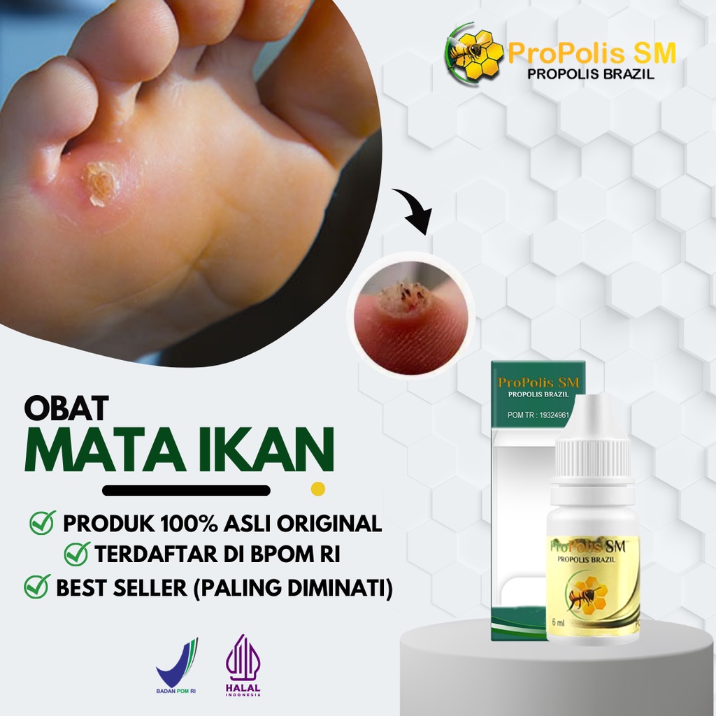 Jual Obat Mata Ikan Telapak kaki Dan Tangan Propolis SM Original Isi ...