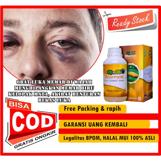 Jual Obat luka memar di wajah, menghilangkan memar biru, kelopak mata ...