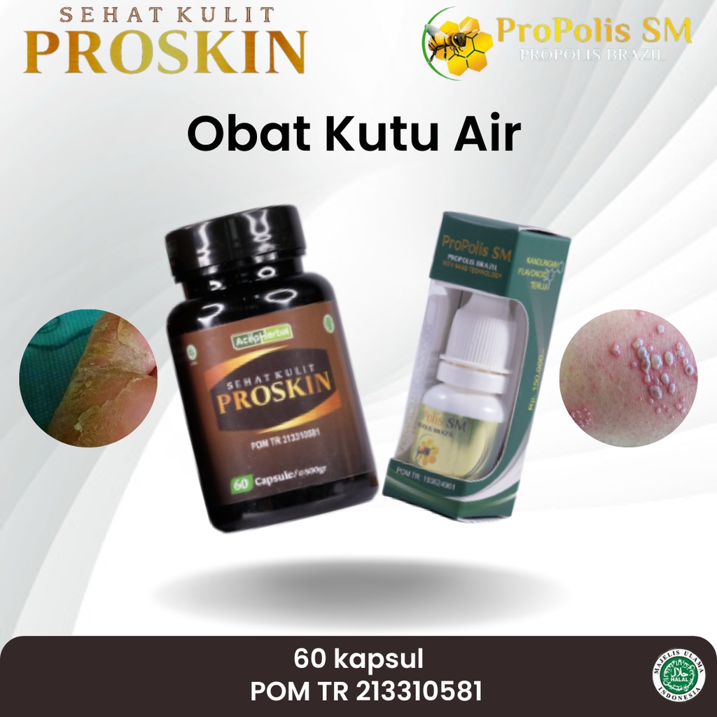 Jual Obat Kutu Air, Kutu Air di Kaki, Kutu Air di Tangan, Kutu Air di ...