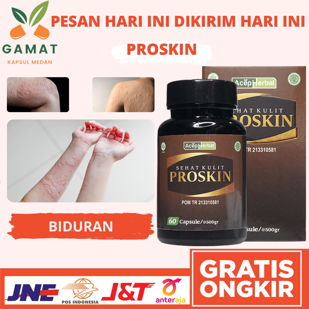 Jual Obat Biduran kaligata Alergi Dingin Bentol Merah Kutu Air Penyakit ...