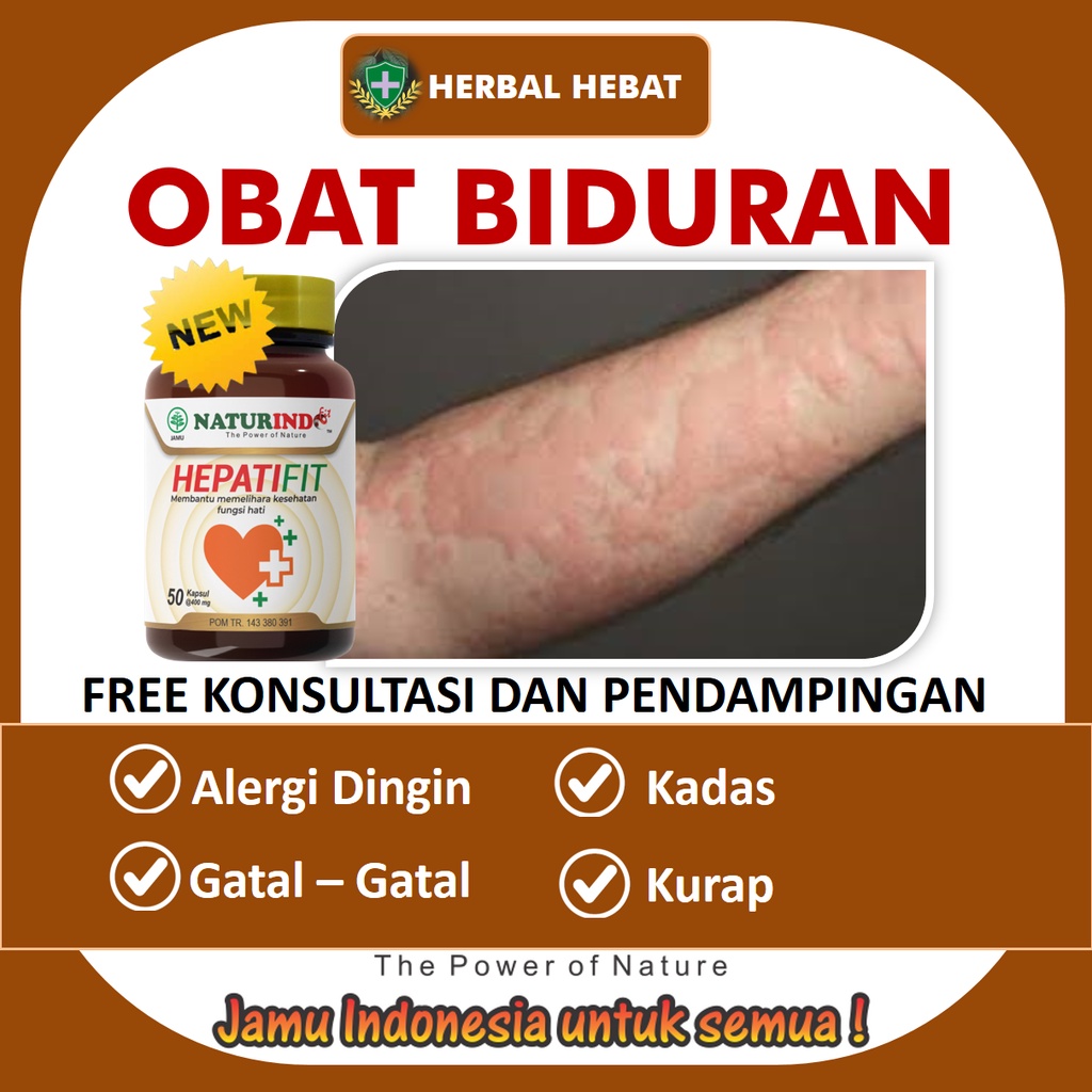 Jual Obat Biduran Gatal Gatal Kulit Alergi Kadas Kurap Kaligata Liver ...