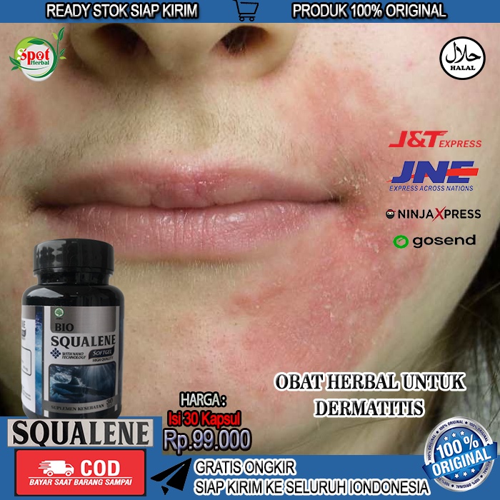 Jual Obat Dermatitis Herbal, Obat Penyakit Kulit Dermatitis, Obat ...