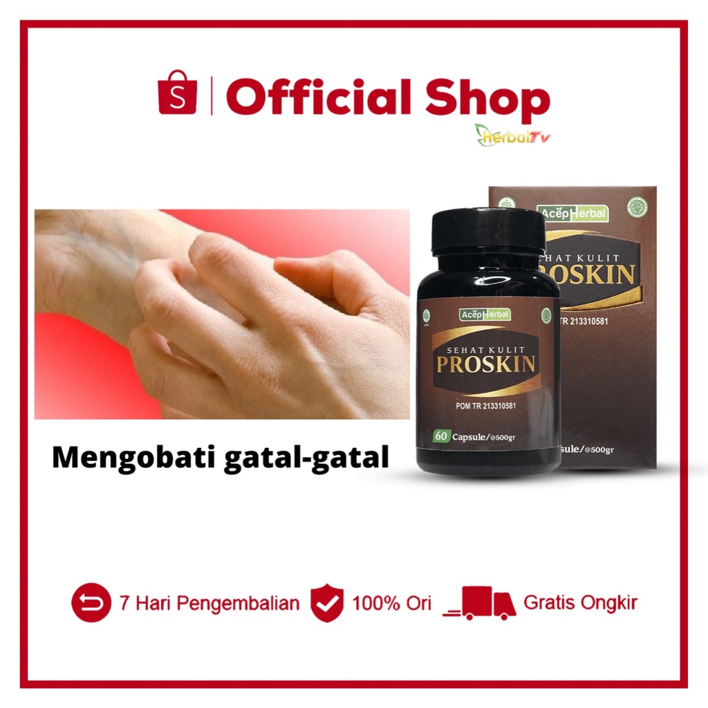 Jual Obat gatal-gatal, alergi gatal, Eksim Proskin Kapsul sehat kulit ...