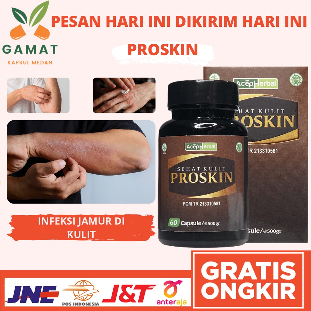 Jual Infeksi Jamur di Kulit Gatal Gatal Scabies Alergi Kulit Kurap Panu ...