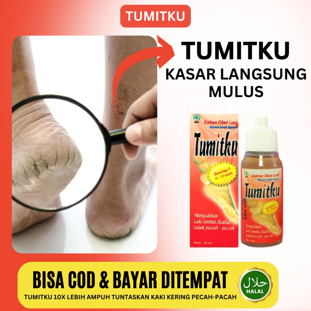 Jual TUMITKU Obat Kaki Pecah Dan Kering Foot Cream Penghalus Tumit Kaki ...
