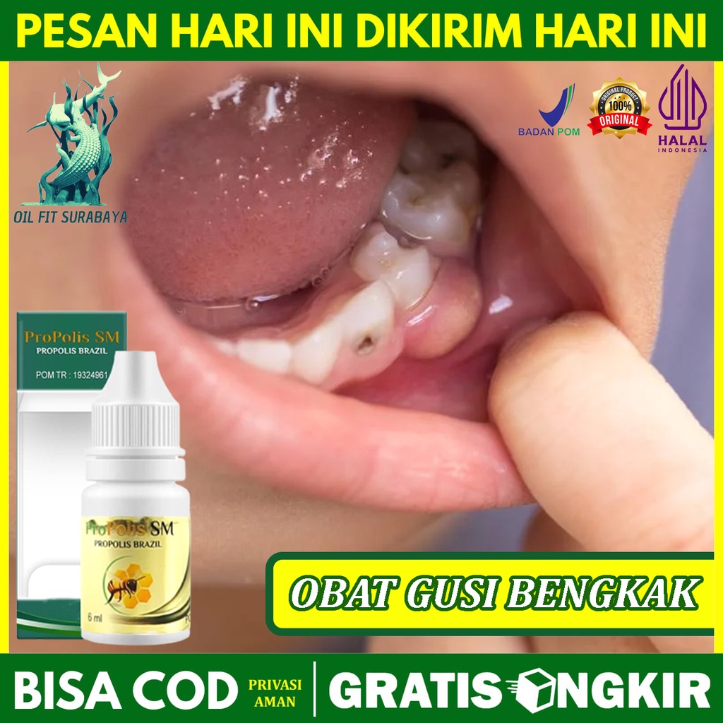 Jual Obat Gusi Bengkak Benjolan Di Bibir Mulut Lidah Mukokel Dengan ...