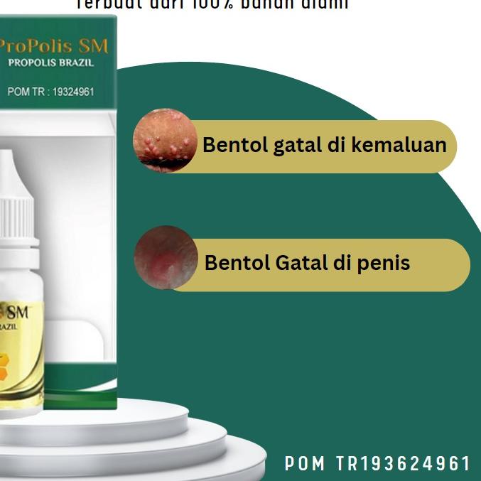 Jual Original Kaka Herbal - Obat Bentol Gatal Pada Area Kemaluan, Obat ...