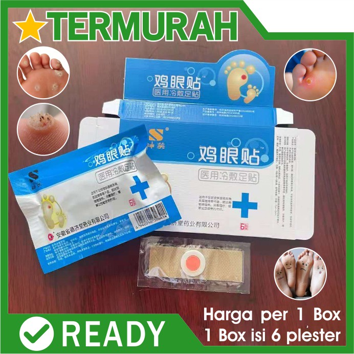 Jual Plester Kutil Mata Ikan Kaki Kapalan Ji Yan Gao Obat koyo bubul ...