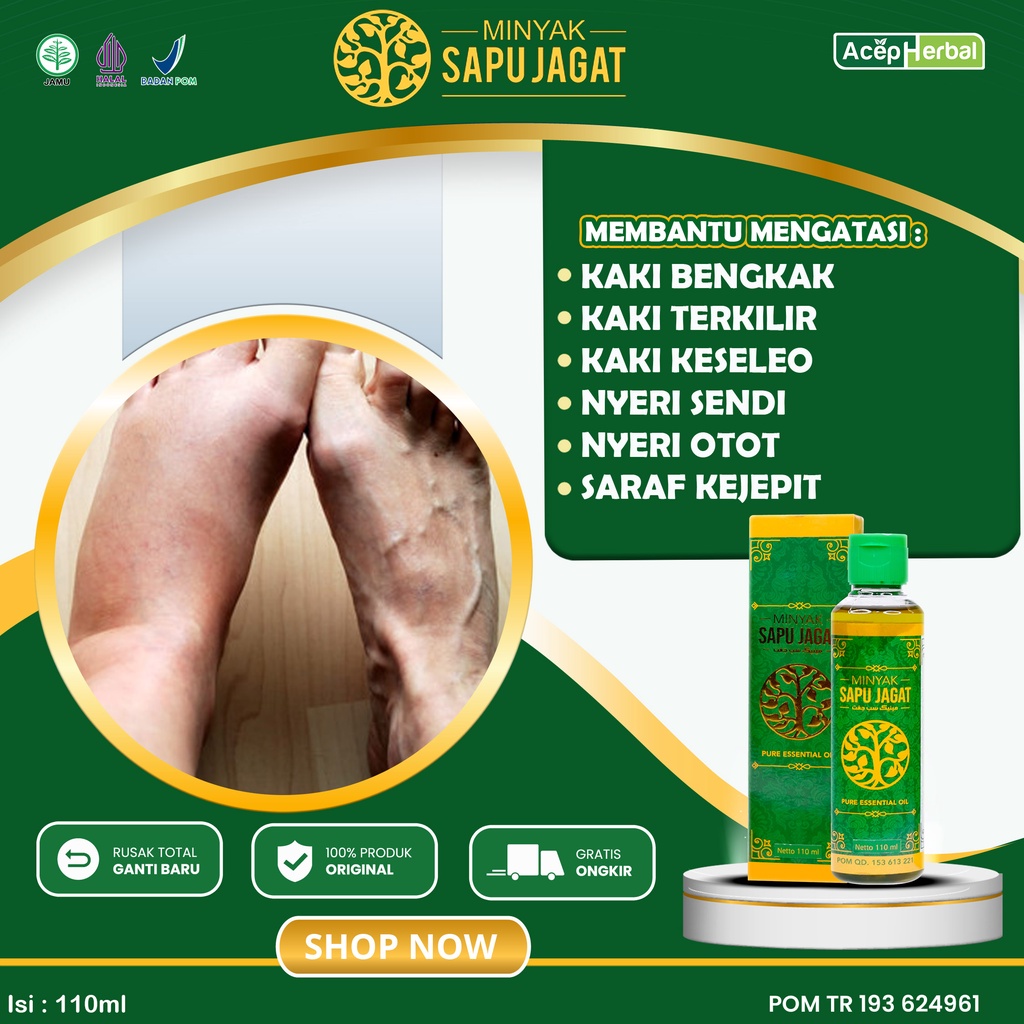 Jual Obat Oles Kaki Bengkak Keseleo Terkilir Nyeri Sendi Lutut Sakit ...
