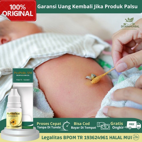 Jual Obat Infeksi Tali Pusar Bayi, Obat Oles Tali Pusar Bayi, Obat ...