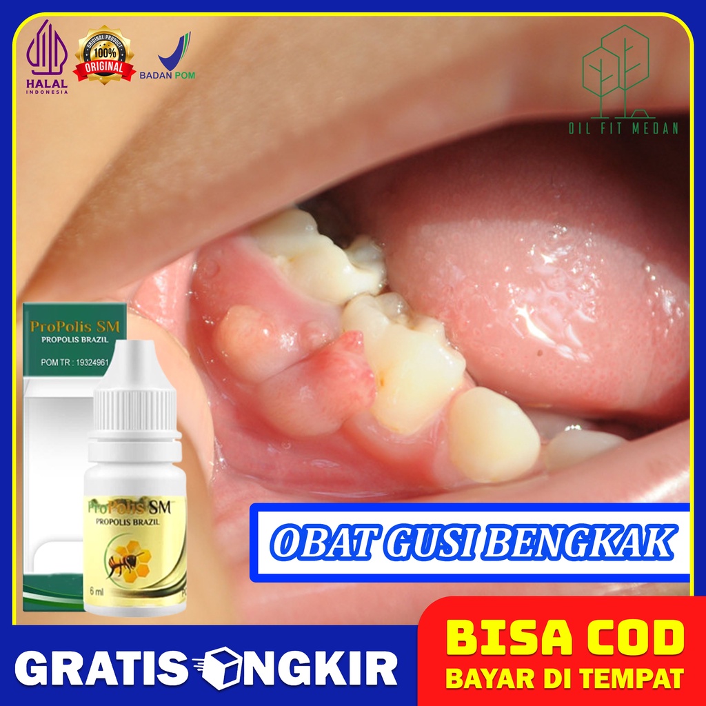 Jual Obat Gusi Bengkak Sakit Gigi Perontok Gigi Berlubang Peradangan ...