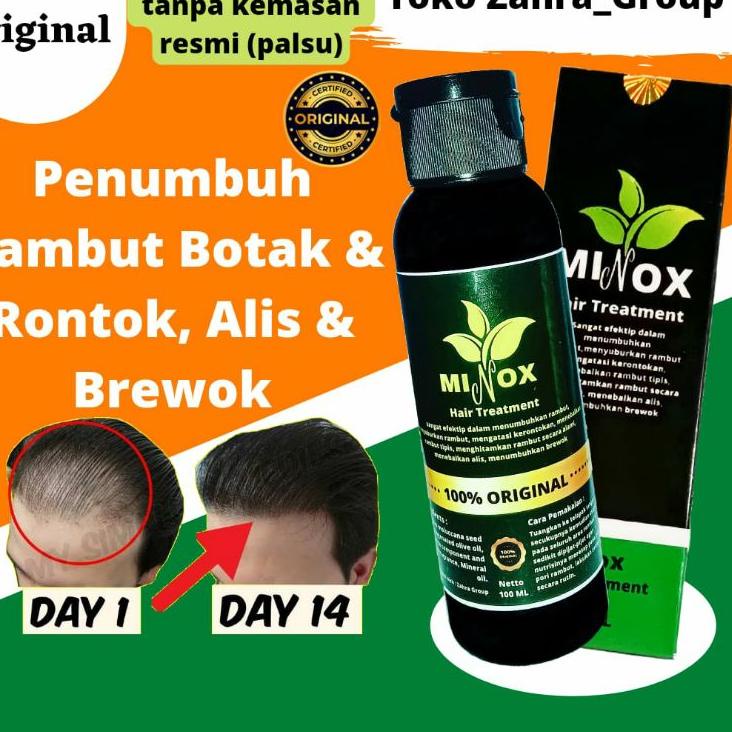 Jual [MINOX] Penumbuh Rambut Botak, Tipis dan Rontok & Brewok Sangat ...