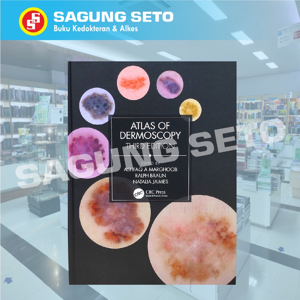 Jual BUKU ATLAS OF DERMOSCOPY 3ED - MARGHOOB / KEDOKTERAN KULIT ...