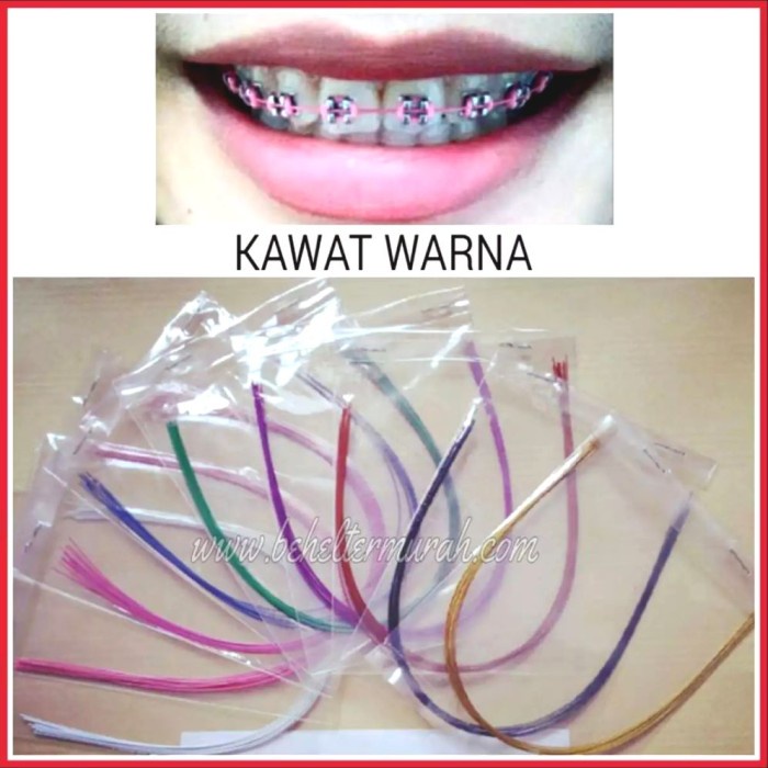 Jual KAWAT NITI WARNA BEHEL PER PACK MIX ( ISI 5 pcs) KAWAT BEHEL ...