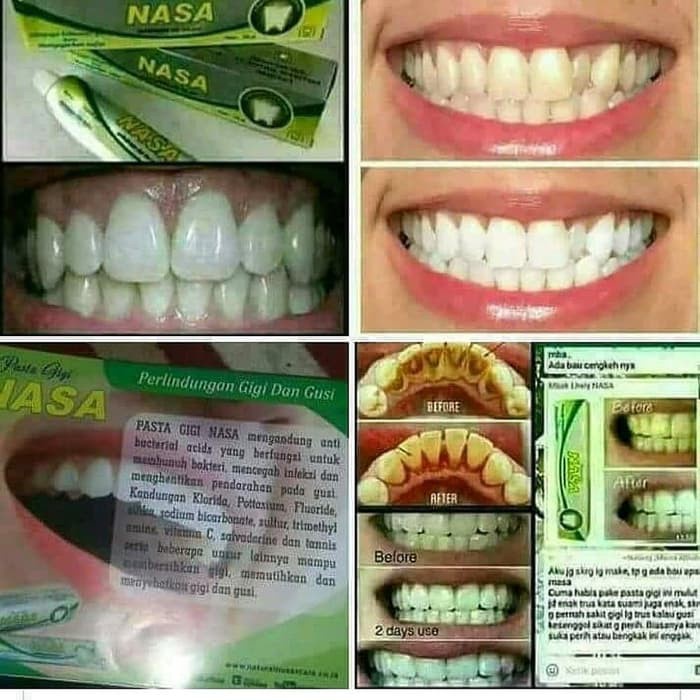 Jual MV PASTA GIGI NASA ODOL NASA ORIGINAL BPOM | Shopee Indonesia