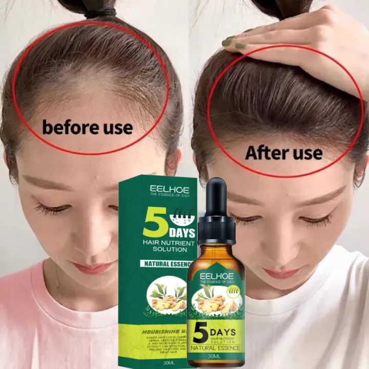 Jual EELHOE Hair Growth Serum PENUMBUH RAMBUT Clothes of Skin 5 Days ...
