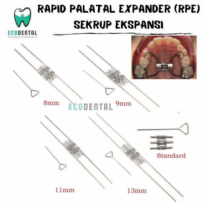 Jual Rapid Palatal Expander Expansion Screw Sekrup Ekspansi Orthodontic ...