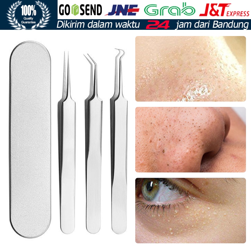 Jual 3Pcs Pinset Komedo Stainless Alat / Jerawat Alat / Penjepit Komedo ...