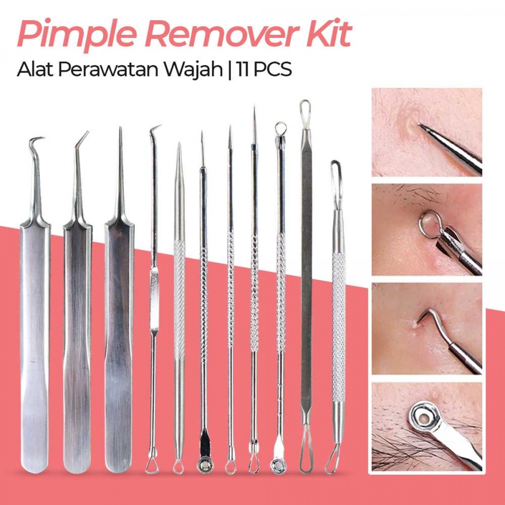 Jual Alat Perawatan Wajah Skin Acne Pimple Remover Kit - DDM11 | Shopee ...
