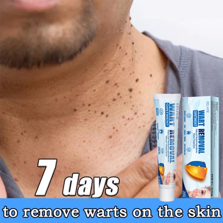Jual SUMIFUN Penghilang Tahi Lalat EELHOE Wart Remover Ointment ...