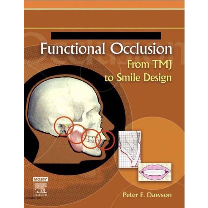 Jual Pdf Function Occlusion From Tmj To Smile Design Shopee Indonesia