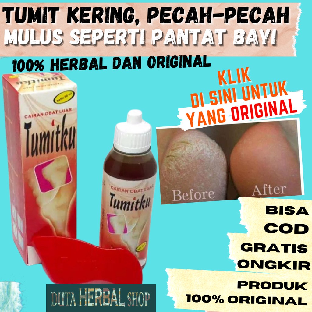 Jual Penghalus Kaki Pecah dan Kering Obat Kaki Tumit Pecah Pecah Kering ...