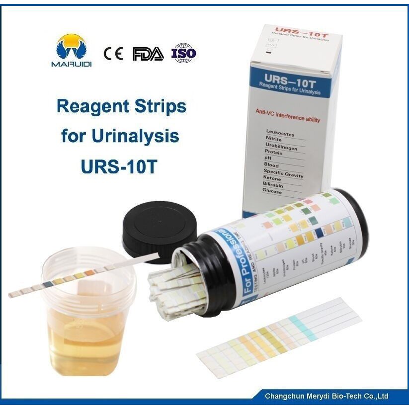 Jual (COD) URINALYSIS REAGENT STRIP 10 PARAMETER 100 STRIP TEST URINE ...