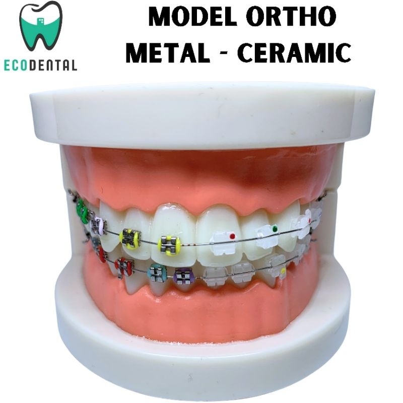 Jual Model Ortho Phantom Gigi Behel Ceramic Metal Model Study Alat ...