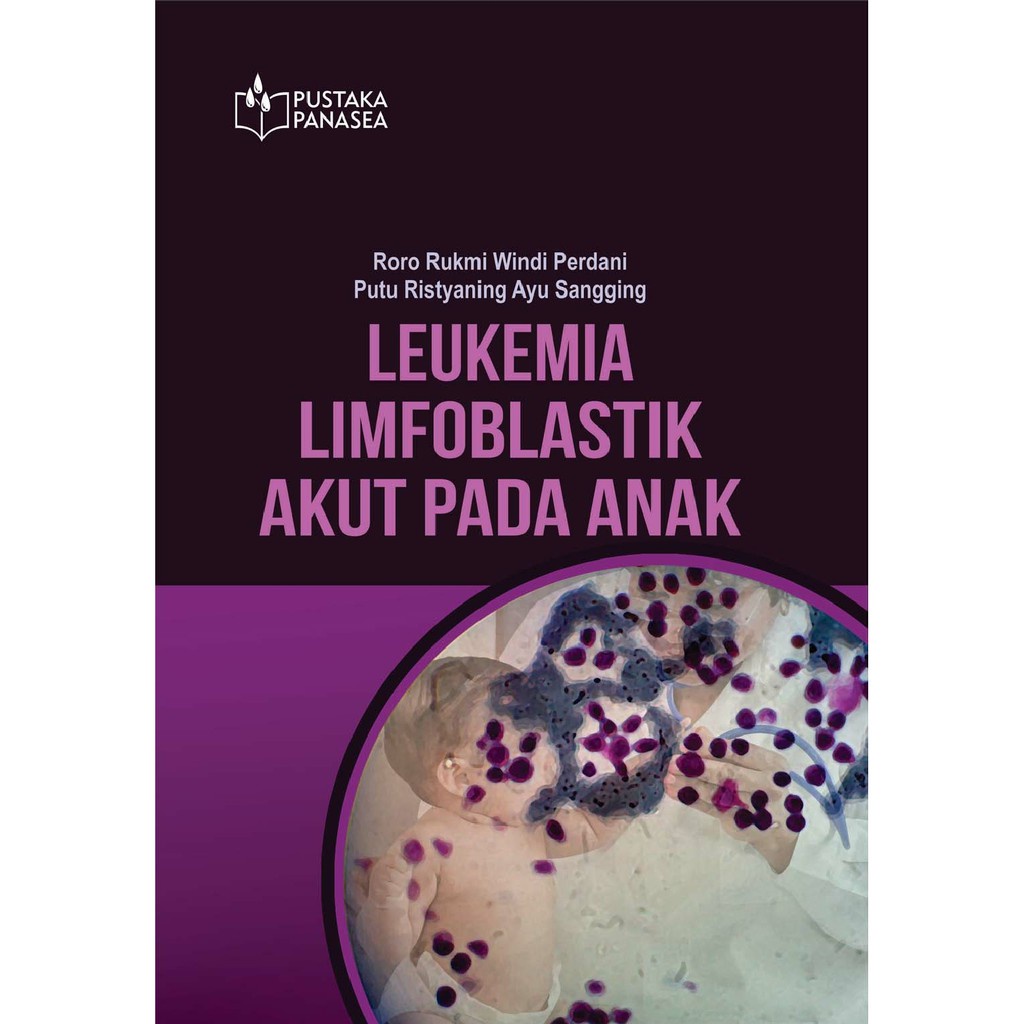Jual Buku Leukemia Limfoblastik Akut Pada Anak - Roro Rukmi | Ready ...