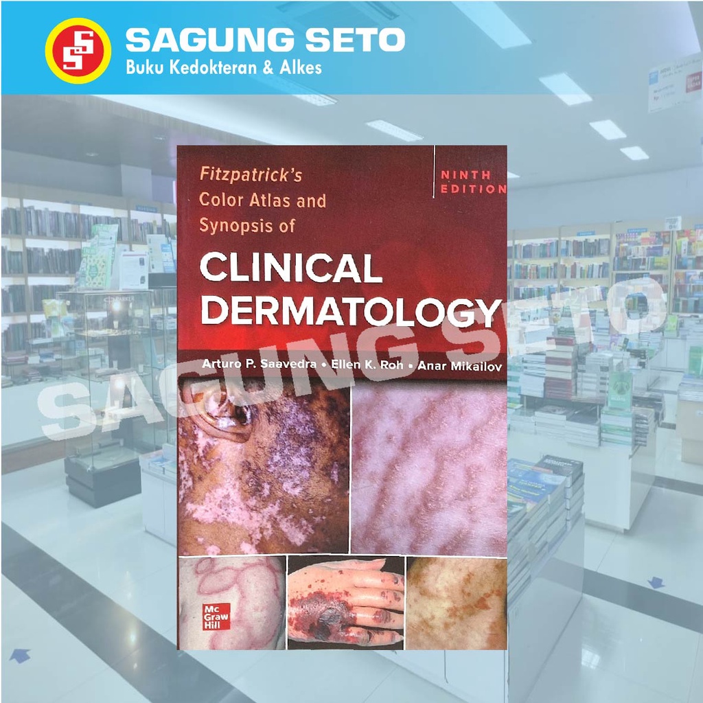 Jual FITZPATRICK COLOR ATLAS AND SYNOPSIS OF CLINICAL DERMATOLOGY 9ED/KULIT | Shopee Indonesia