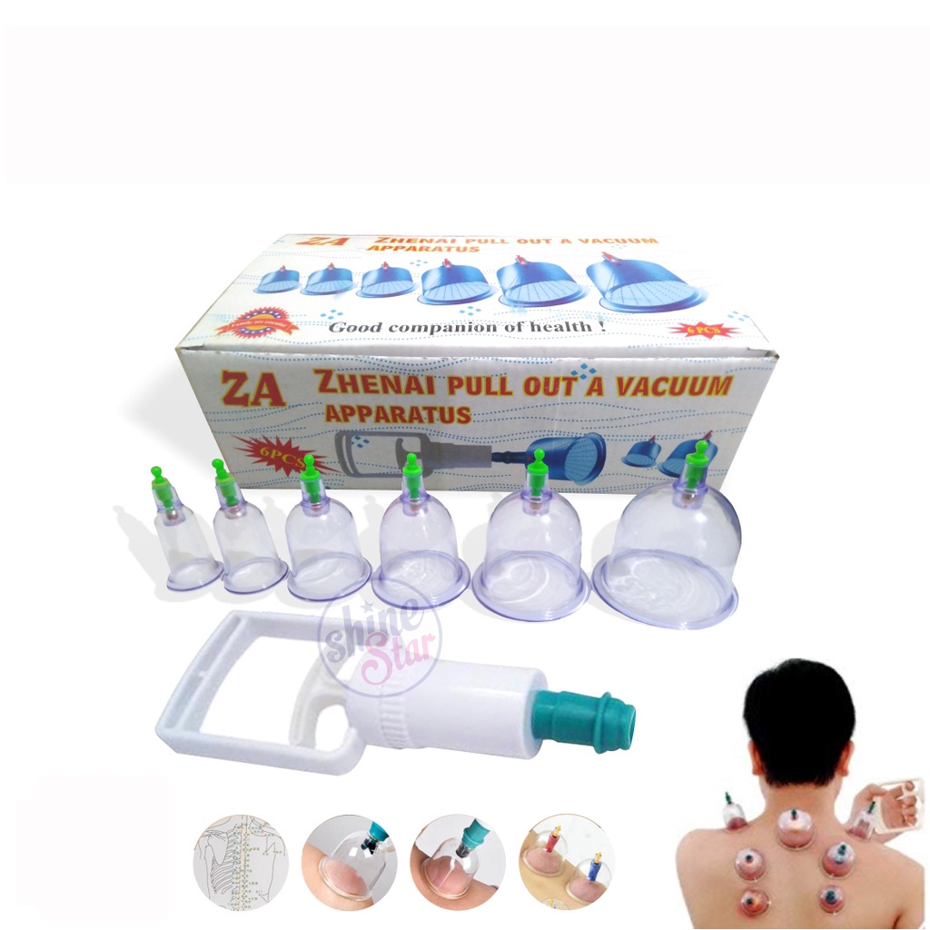 Jual Kop Angin Bekam - Alat Bekam Lengkap Kop Angin Kongsui Isi 6 Cup Untuk Menyembuhkan ...