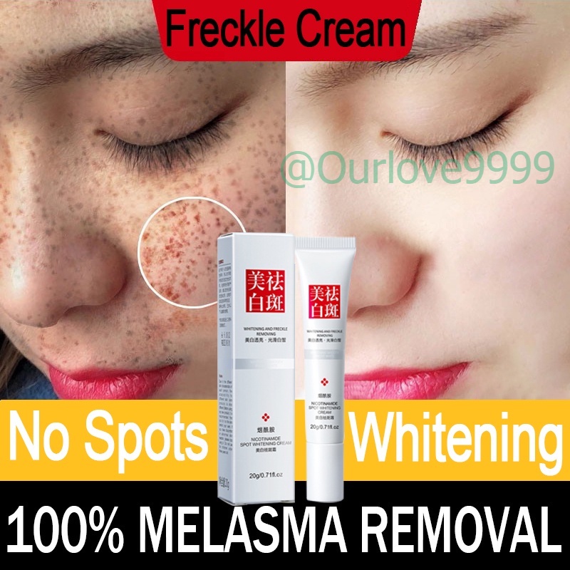 Jual Pemutih wajah cream Flek cream bintik pemutih Krim penghilang flek Remove Dark Spots Anti ...