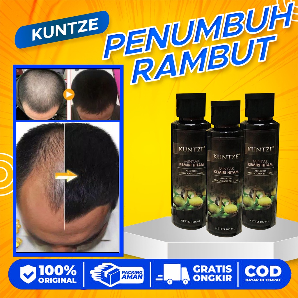 Jual Penumbuh Rambut Botak Penghitam Rambut Penghilang Uban Obat Rambut ...