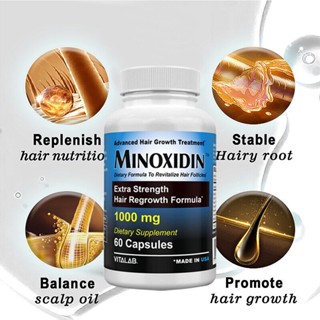 Jual Minoxidin Biotin Hair Regrowth untuk rambut sehat 30 kapsul ...