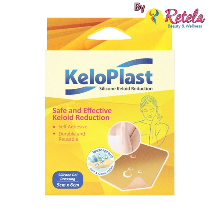 Jual KELOPLAST SILICON KELOID R.5X6CM/ SCAR/ BEKAS LUKA | Shopee Indonesia