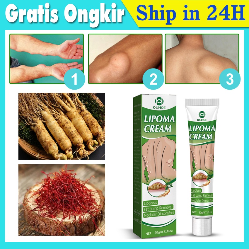 Jual Salep Lipoma Salep Benjolan 20g Obat Lipoma Obat Benjolan ...