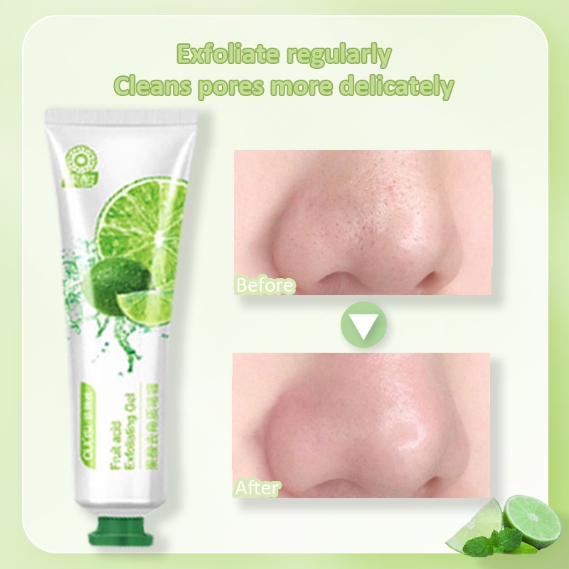 Jual OULISI Fruit Acid Exfoliating Gel Facial Mengangkat Kulit Mati ...